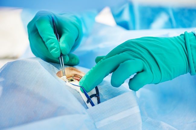 Biaya Lasik Mata Ternyata Nggak Murah, Asuransi Bisa Cover? - Ruang meNYALA